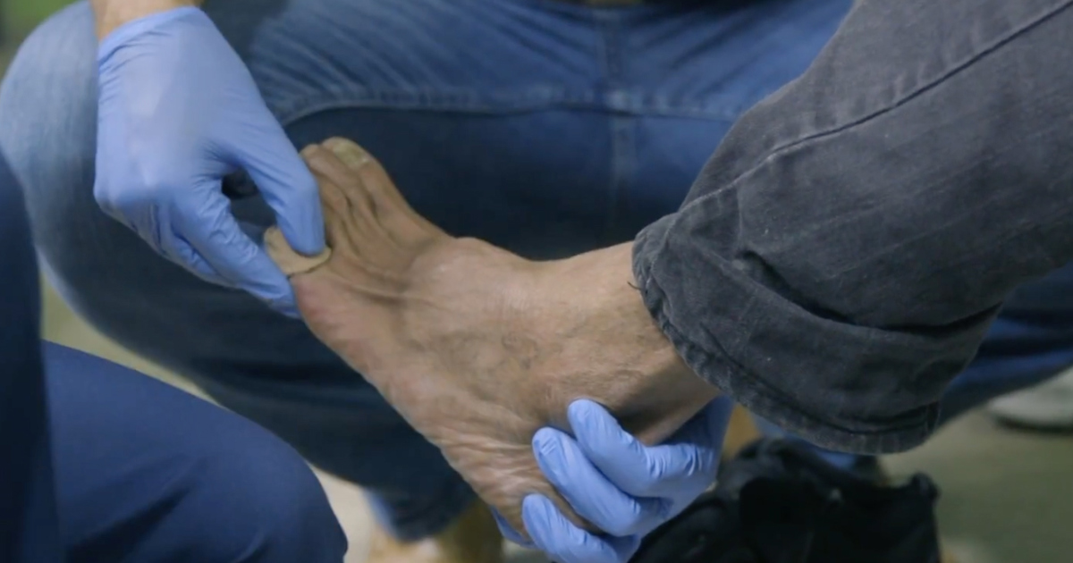 Providing Foot Care To Those In Need | Midwest Orthopaedics at Rush