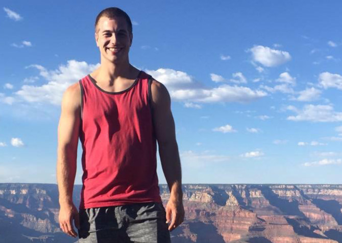 Indiana Man and Pro Quarterback Share Unusual Shoulder Injury | Midwest ...