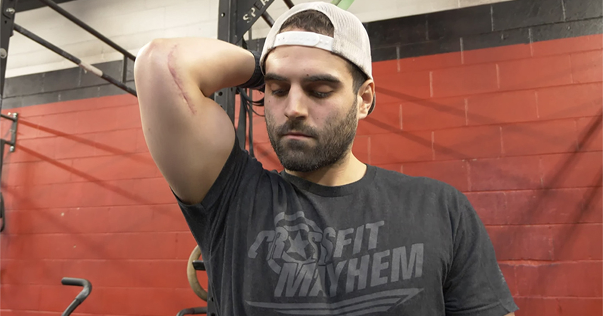 Back to CrossFit After Elbow Surgery | Midwest Orthopaedics at Rush